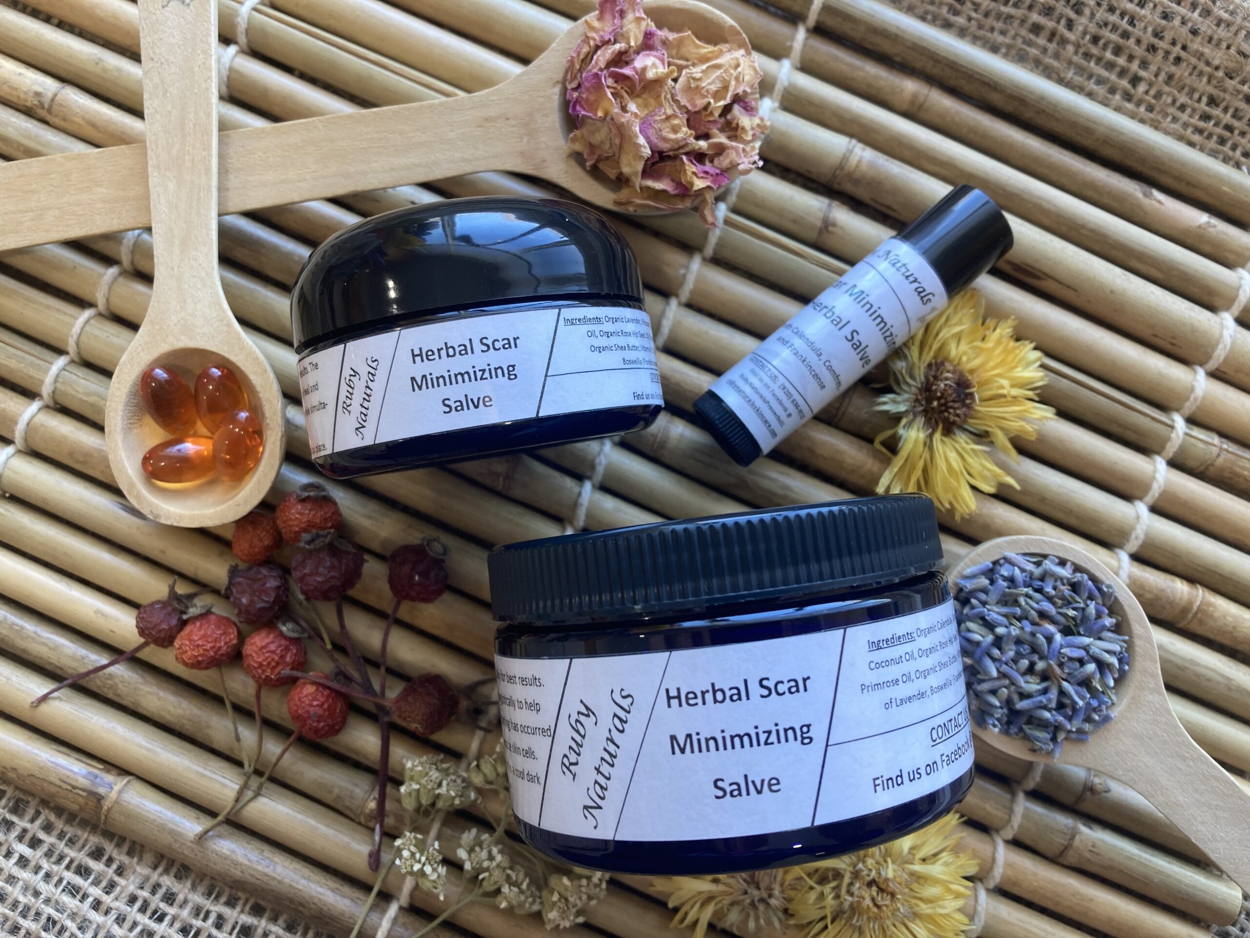 (2 oz.) Scar Minimizing Herbal Salve – Ruby Naturals