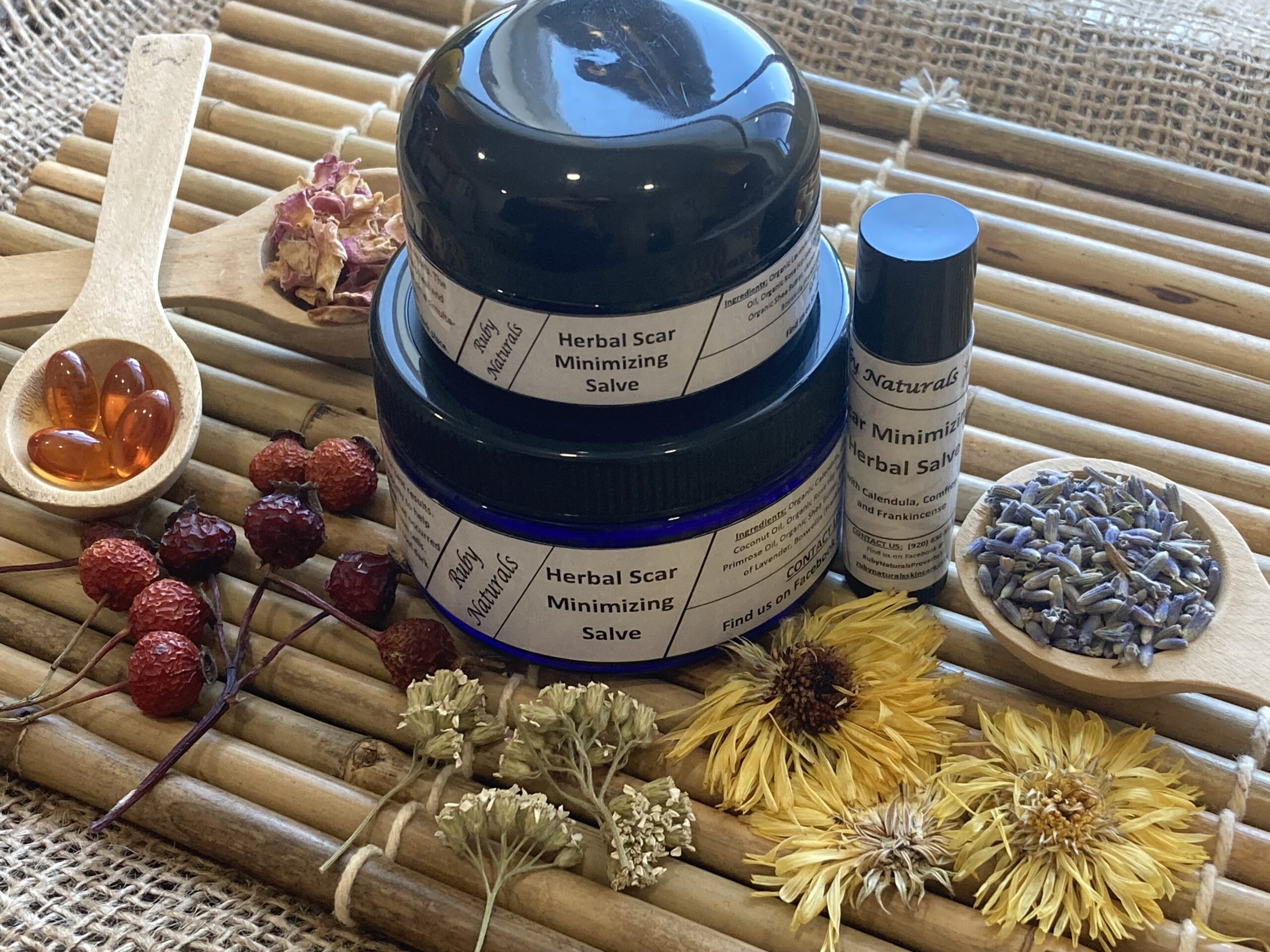 (2 oz.) Scar Minimizing Herbal Salve – Ruby Naturals